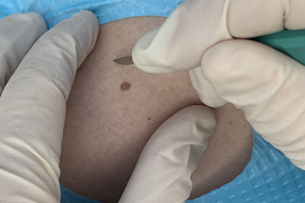 Our Services - Welcome to DMSI - Professional Surgical Dermatology ...